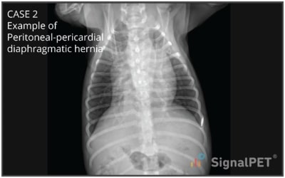 Radiology Case of the Week | Peritoneal Pericardial Diaphragmatic Hernias