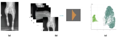 The AI Radiology Blog – Chapter 1: What is AI